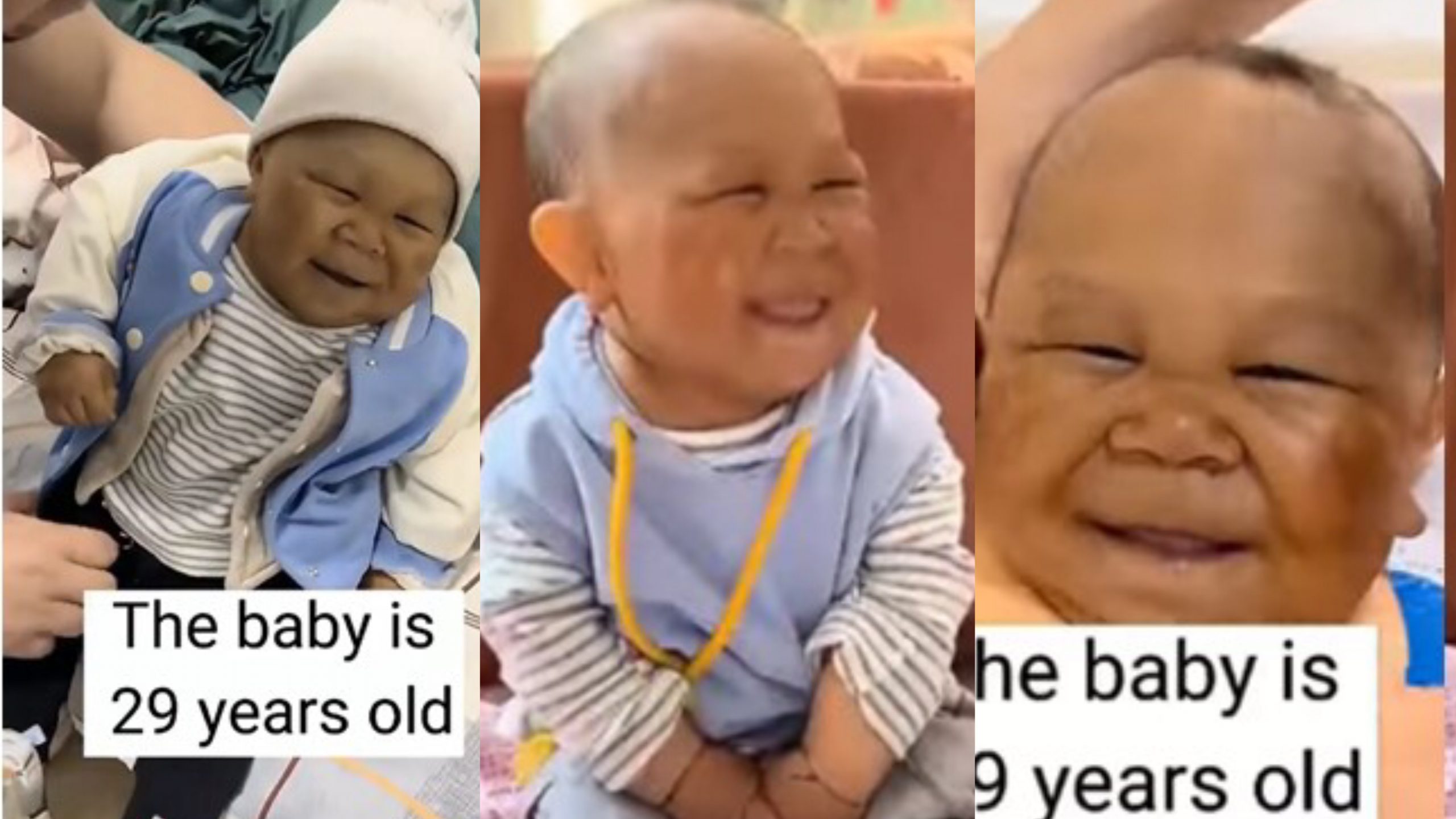 Meet the 29-year-old ‘baby’ who can’t grow due to a sickness called ...