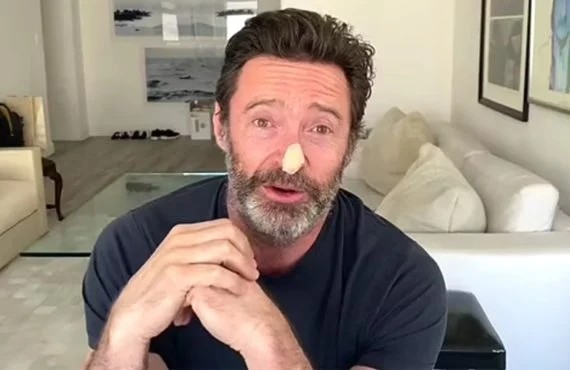 ‘Wolverine’ actor Hugh Jackman opens up on new skin cancer scare ...